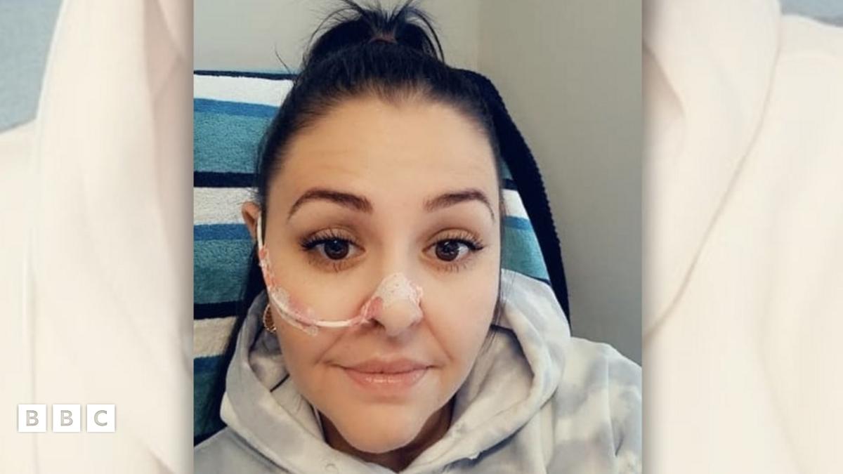 Triniaeth dramor: 'Mae wedi bod yn uffern' - BBC Cymru Fyw