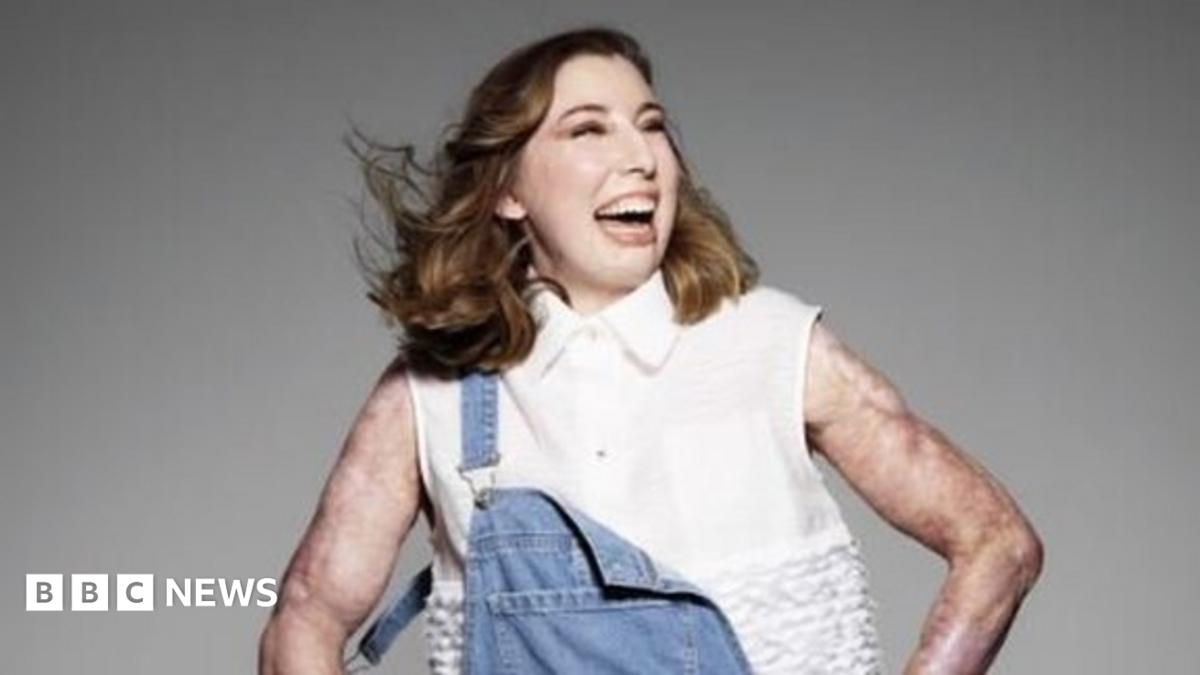 Burns survivor Catrin Pugh is face of Avon beauty campaign - BBC News