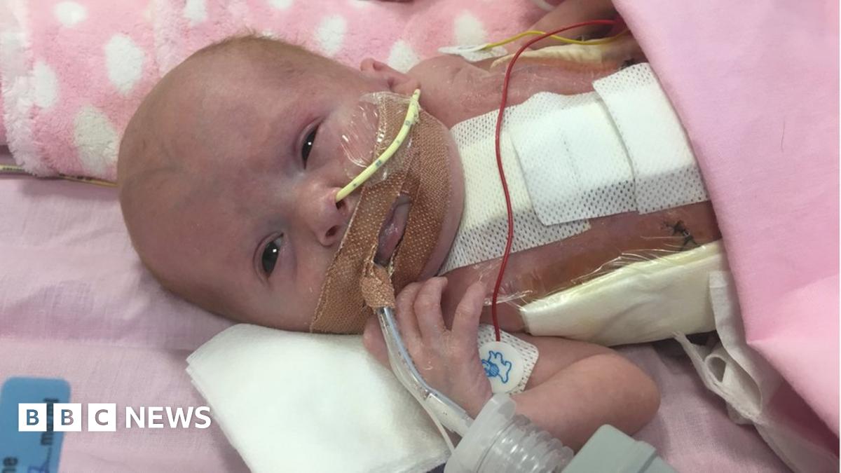 Baby born with heart outside body is home in Bulwell - BBC News