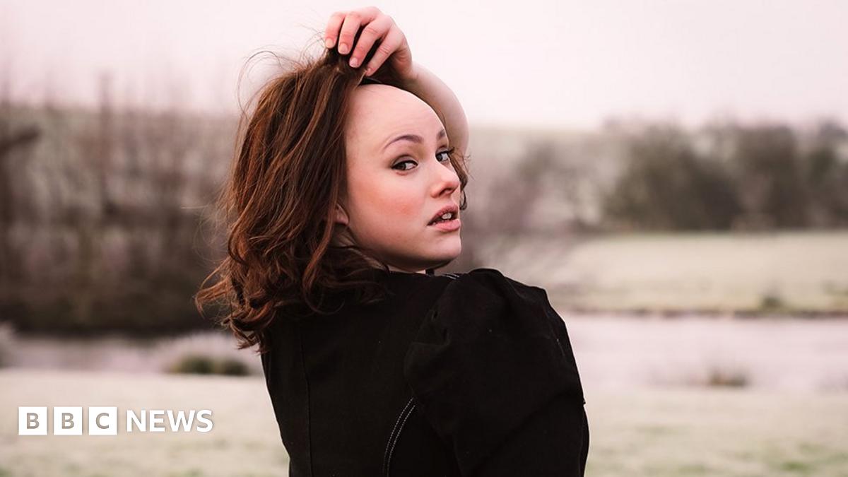 Woman with alopecia hopes trolls listen to her Ted Talk - BBC News