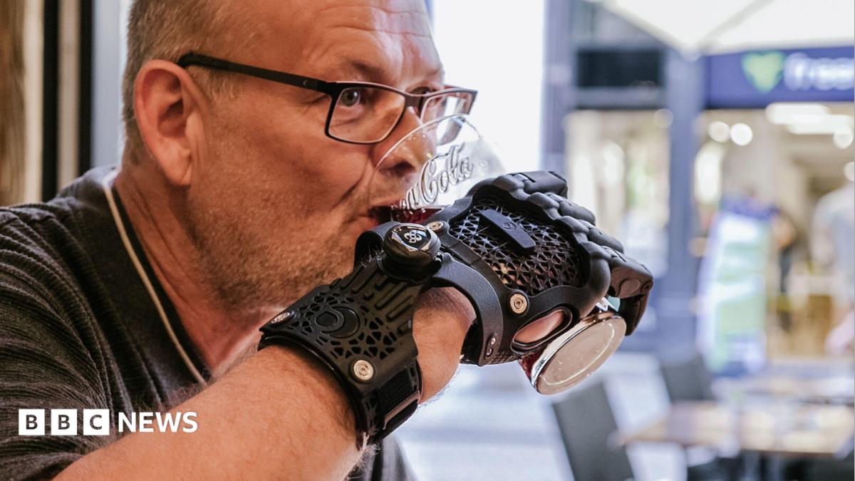 Bristol: First person receives pioneering bionic hand - BBC News