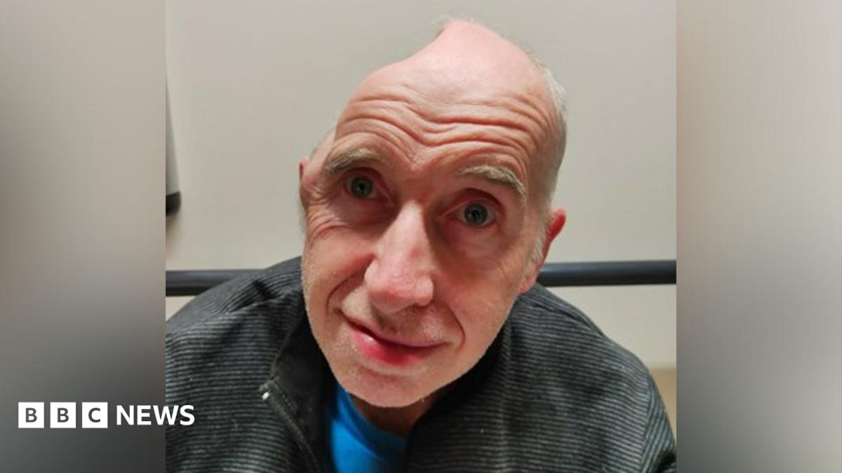 Stroke survivor: 'A wheelchair will give me freedom' - BBC News