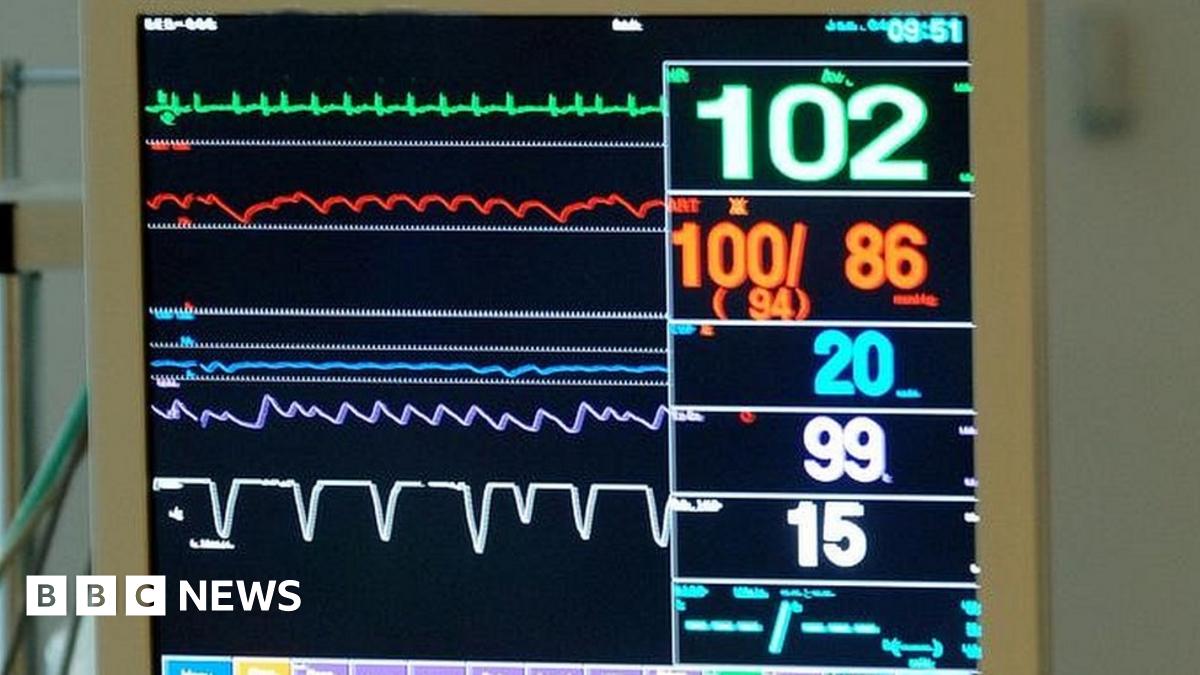 How Bristol's major trauma centre works - BBC News