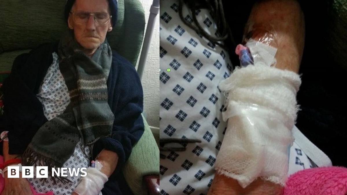 Man discharged from Sandwell Hospital with cannula in arm - BBC News