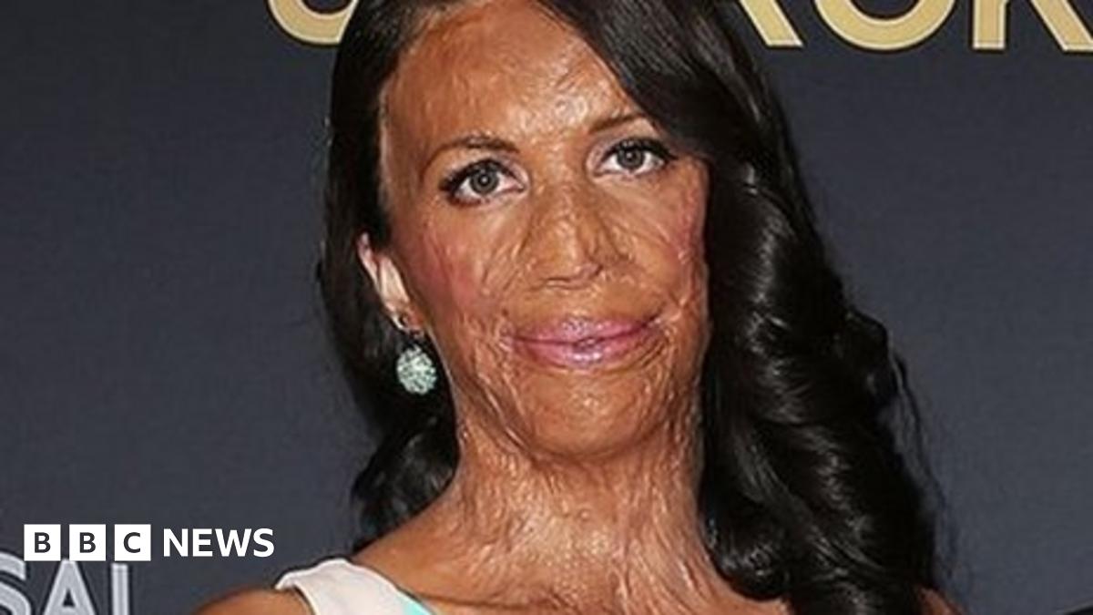 Australian burns survivor Turia Pitt completes triathlon - BBC News
