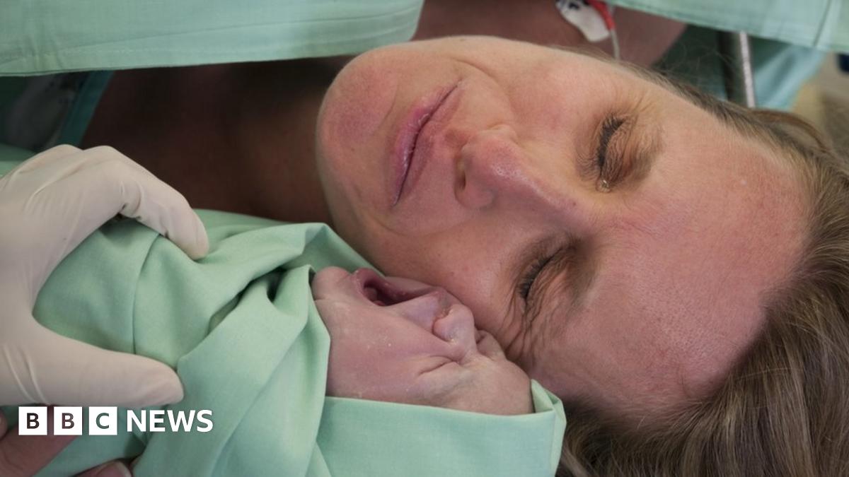 Caesarean births 'affecting human evolution' - BBC News
