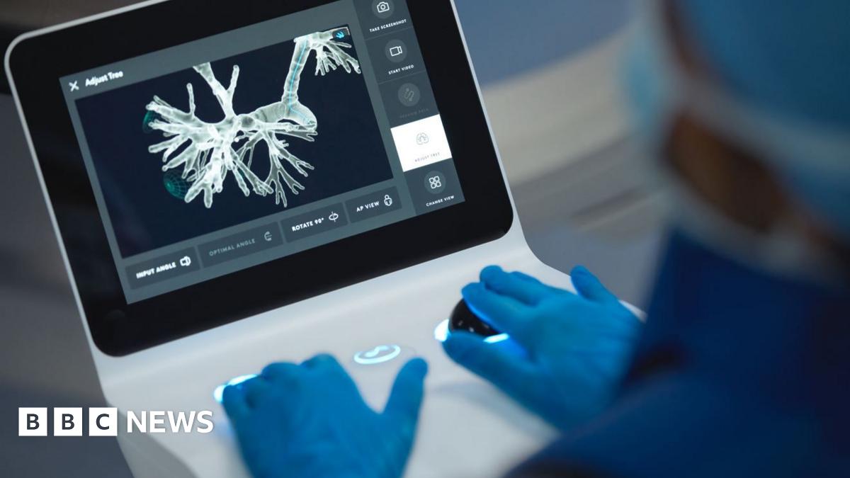 Lung cancer: Robotic probe helps doctors make earlier diagnoses - BBC News