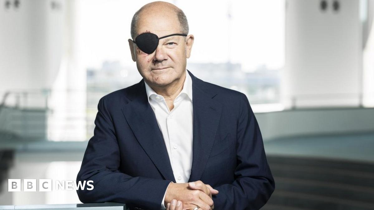 Chancellor 'Pirate Olaf' Scholz injured jogging - BBC News