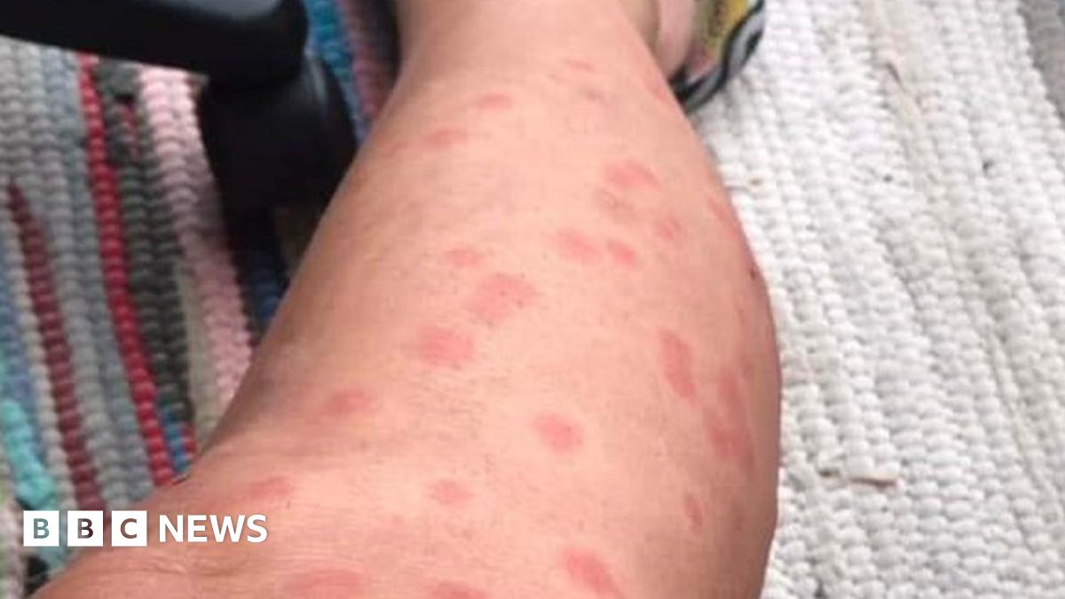 Residents being bugged by biting insect swarms in Lincolnshire village ...