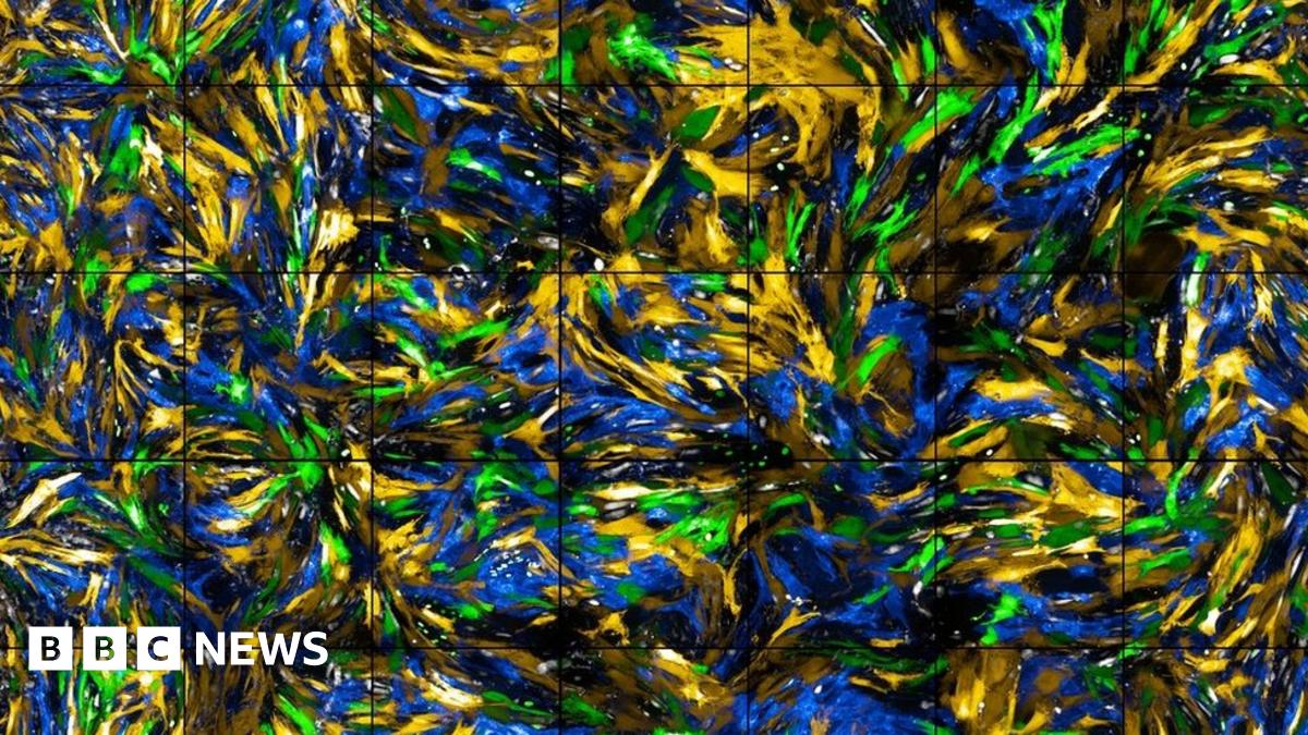 British Heart Foundation: A colourful image of blood vessel cells wins ...