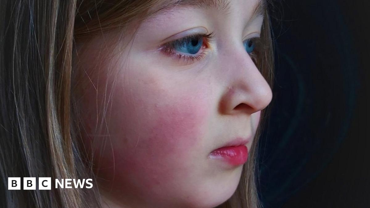 Long Covid: NHS legal action launched by family of girl - BBC News