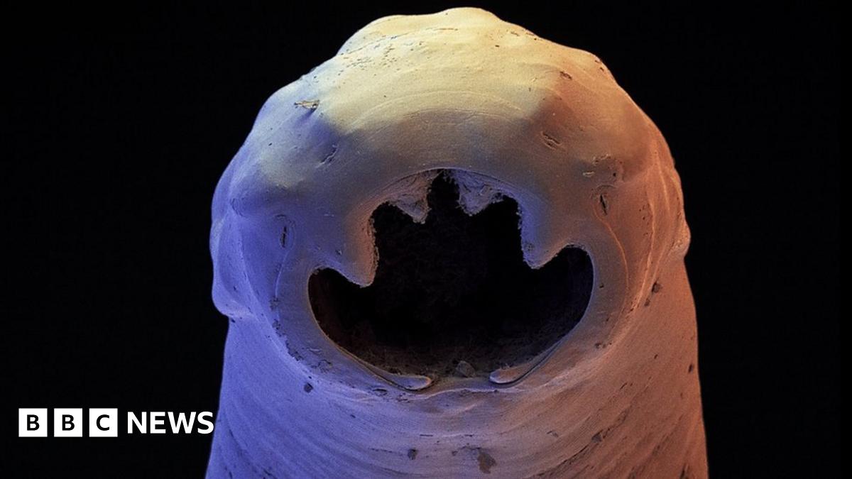 Call for mass de-worming exercise - BBC News