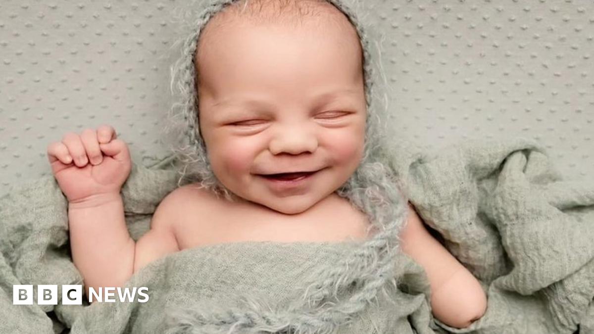 Disability: Anglesey parents' pledge to baby born without hand - BBC News