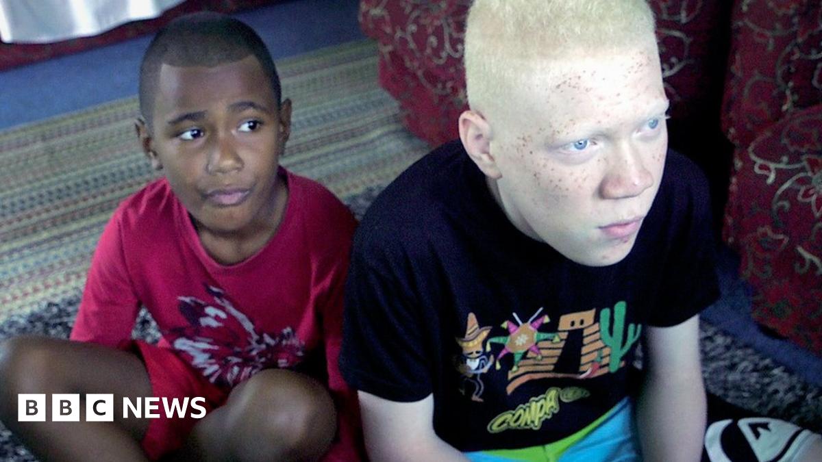Film highlights Fiji's baffling rate of albinism - BBC News