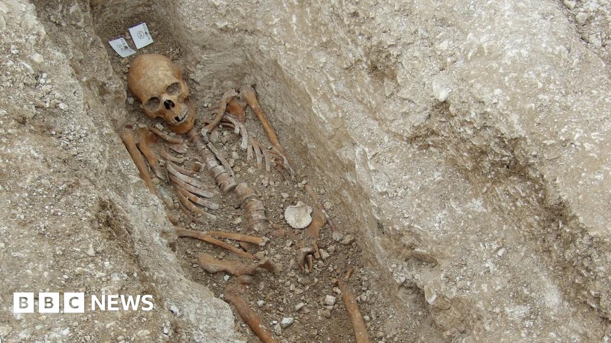 Skeleton offers clues to medieval spread of leprosy - BBC News