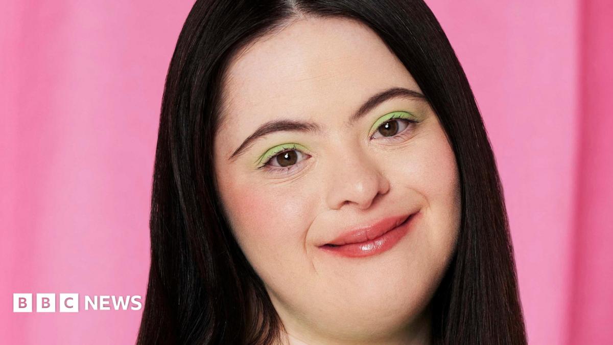 Vogue model Ellie Goldstein: 'Doctors said I wouldn't walk or talk ...
