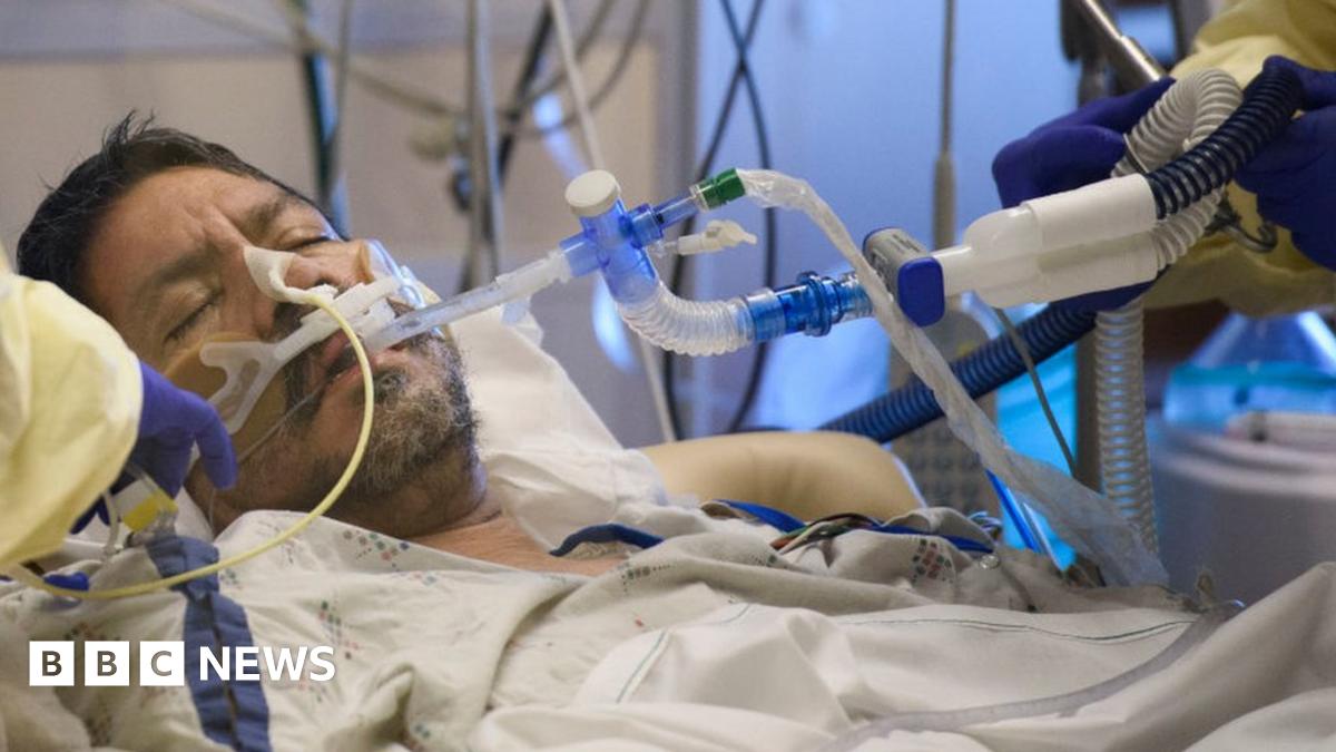 Does US really have world's highest Covid death toll? - BBC News