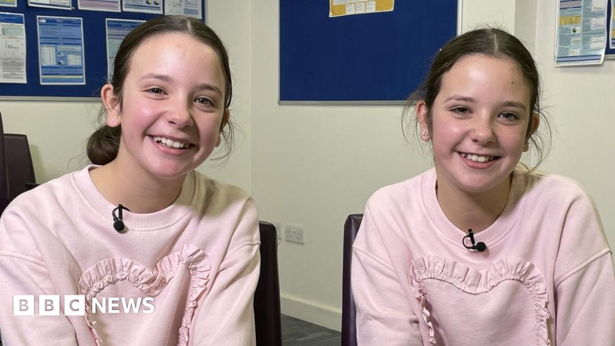 Conjoined twins: Defying the odds to survive - BBC News