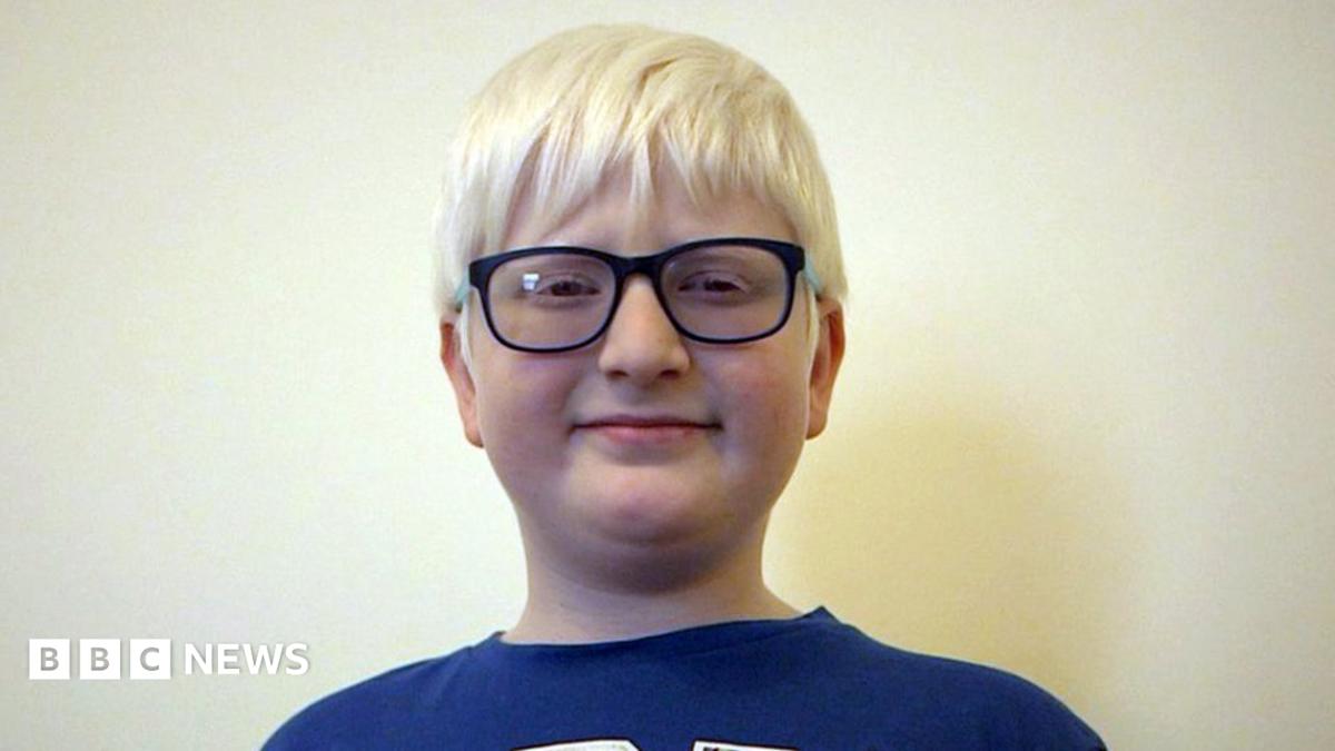 Living with albinism in the UK - BBC News