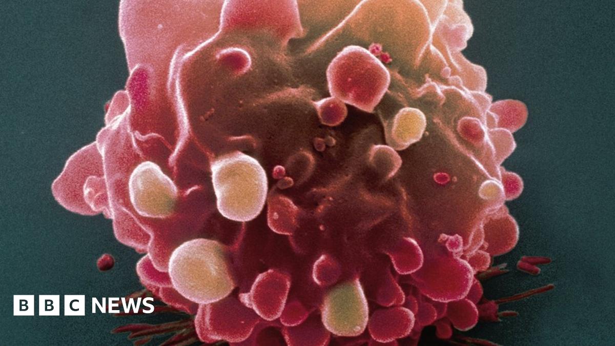 What will President Obama's cancer 'moonshot' achieve? - BBC News