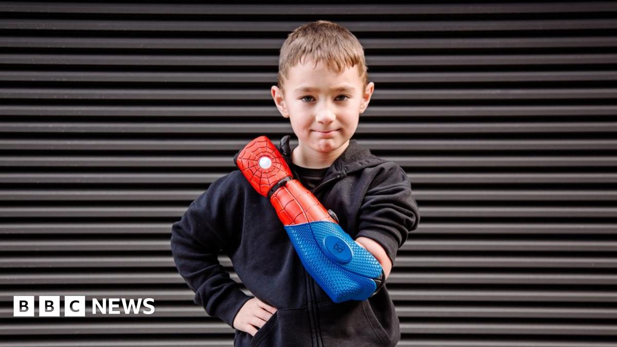 Somerset boy receives life-changing Spider-Man bionic arm - BBC News