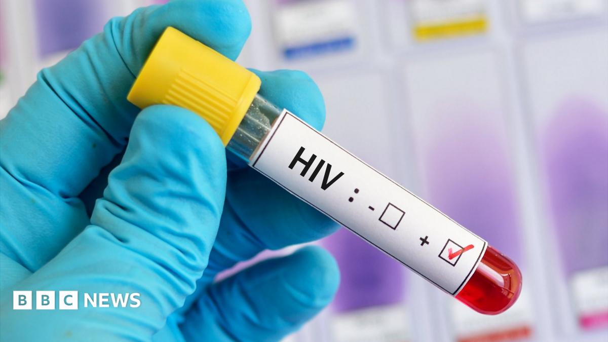 HIV infections among gay and bi men fall by 71% in UK - BBC News