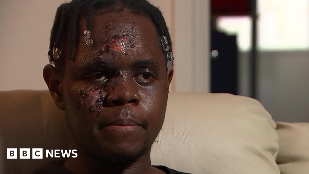 Bristol race attack victim K-Dogg 'glad to be alive' - BBC News