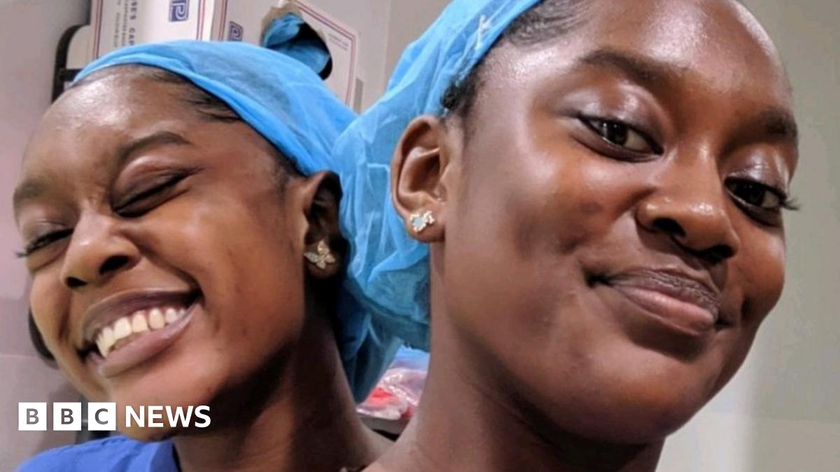 Conjoined twins: 'We always knew we were different' - BBC News