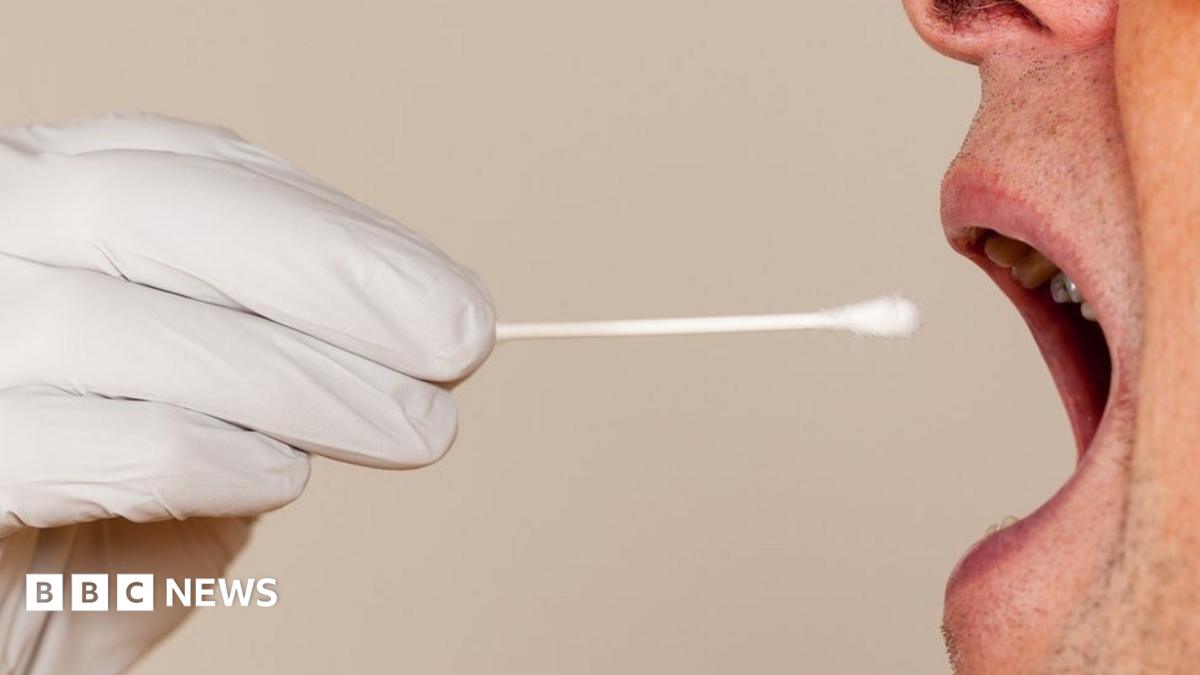 Prostate cancer spit test is trialled - BBC News