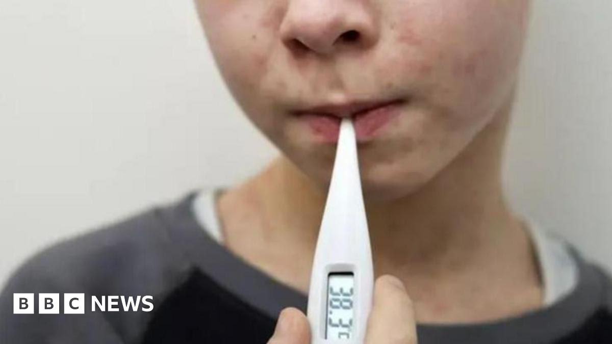 Measles warning for parents in East Sussex - BBC News