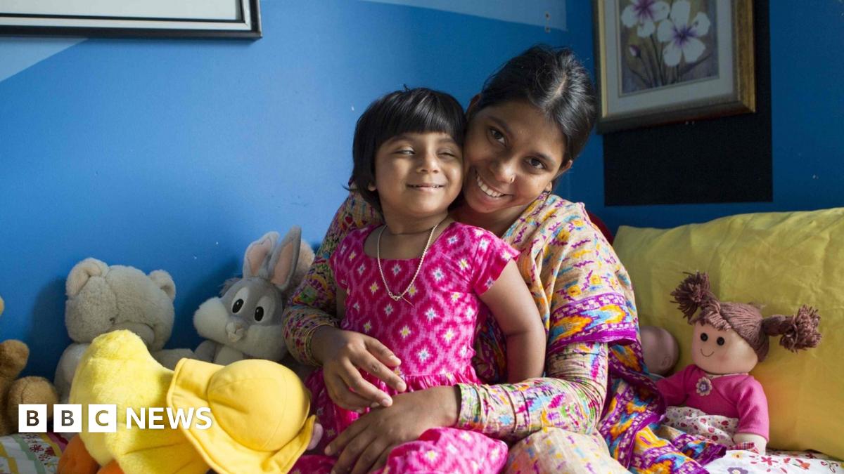 Toddler born with three legs going home to Bangladesh after surgery in ...