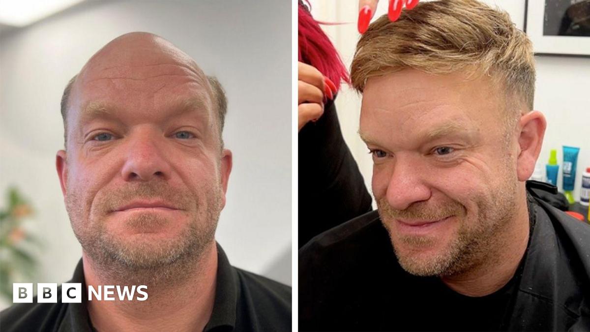 'We need to break the stigma around toupees' - BBC News