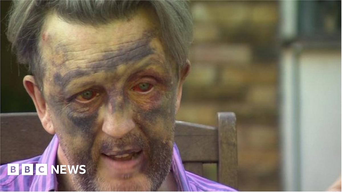 Attack victim Paul Kohler loses police stations battle - BBC News
