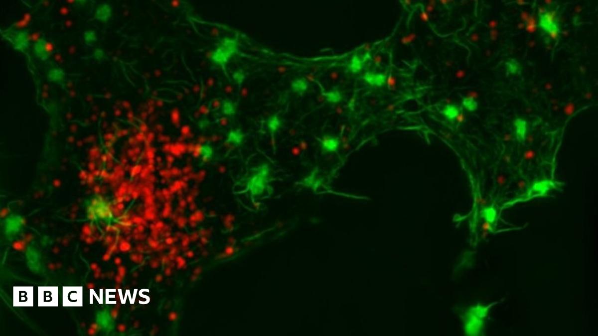 Scientists develop LED technique to help diagnose cataracts - BBC News