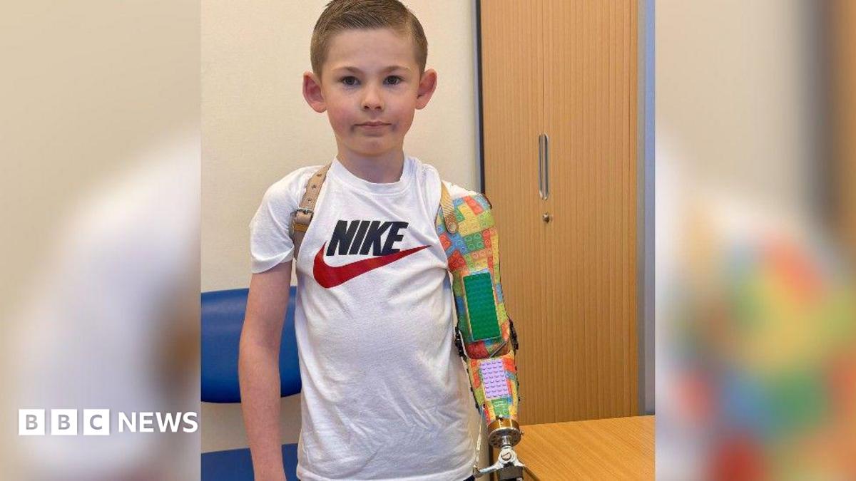 Portsmouth boy, 8, gets bespoke Lego prosthetic arm - BBC News