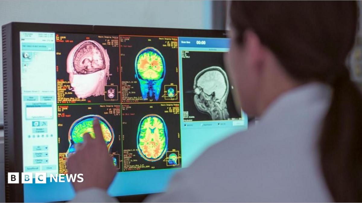 Extra MRI and CT scans available at Milford hospital in Surrey - BBC News