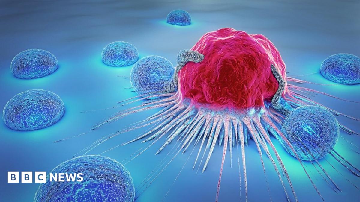 Funding boost for Nottingham prostate cancer research - BBC News