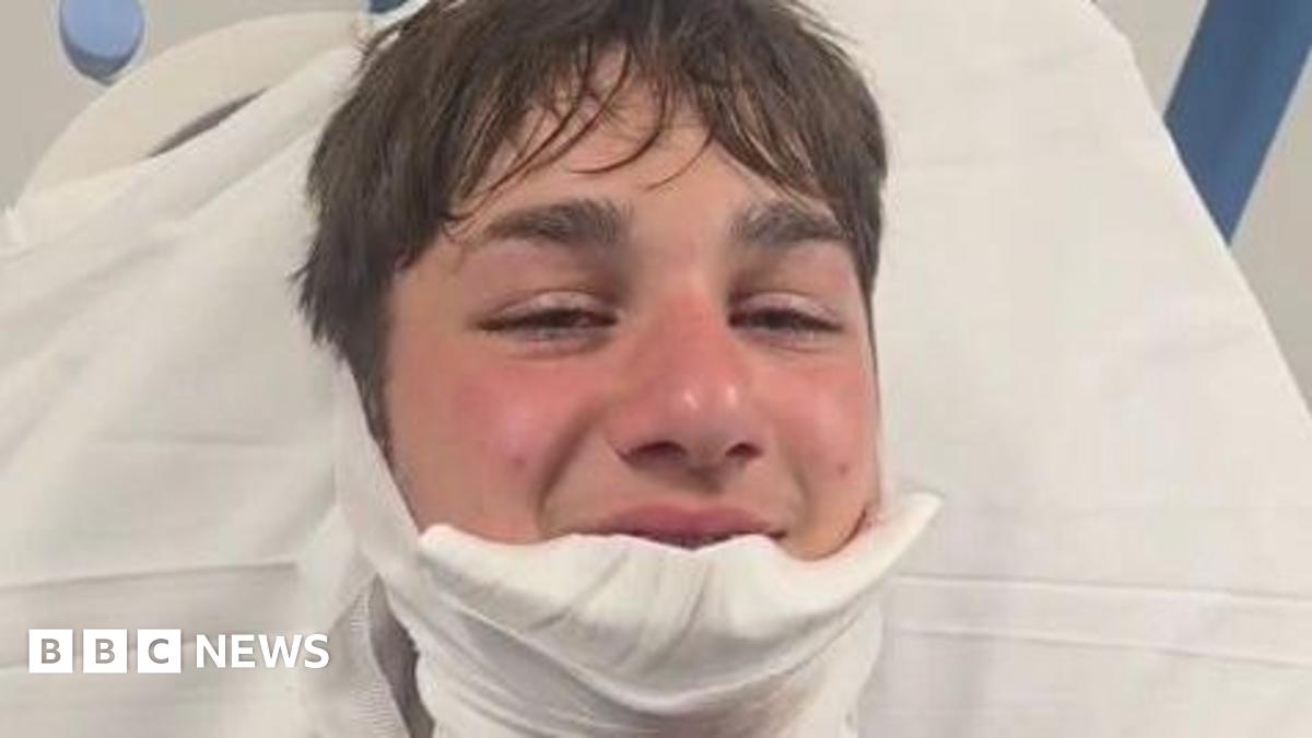 Lowestoft mum condemns police after son impaled on metal fence - BBC News