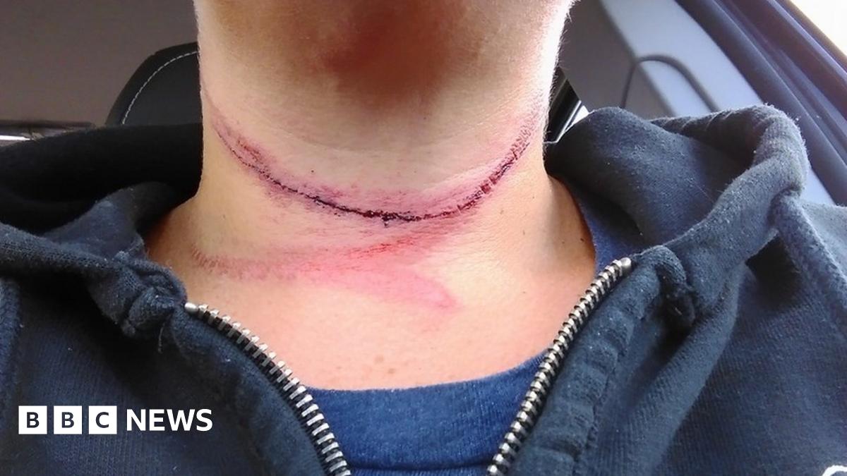 Woman suffers neck wounds after safety failure at the Eden Project ...