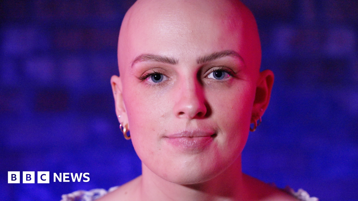 Alopecia: Woman describes how she could not look in the mirror - BBC News