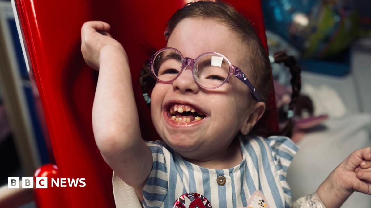 Edwards' syndrome: Parent's say daughter is a 'little miracle' - BBC News