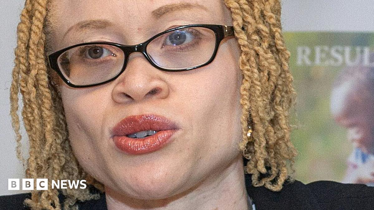 People with albinism in Malawi face 'total extinction' - UN - BBC News