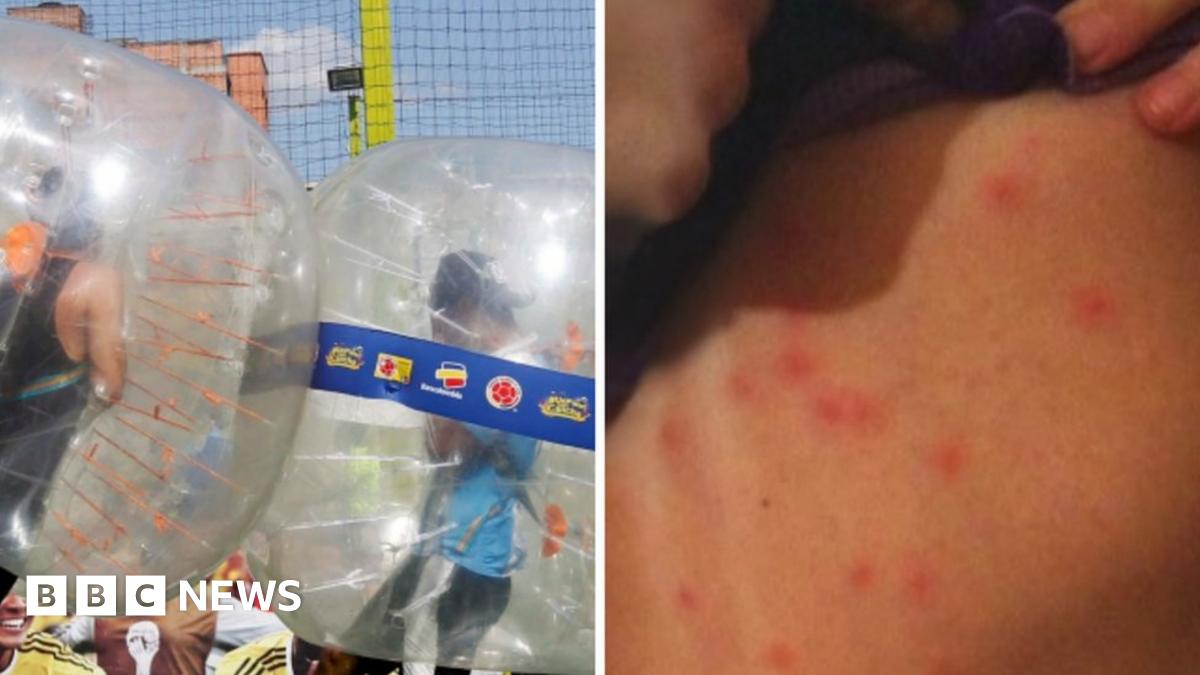 Zorb balls destroyed after Gloucester party children fall ill - BBC News