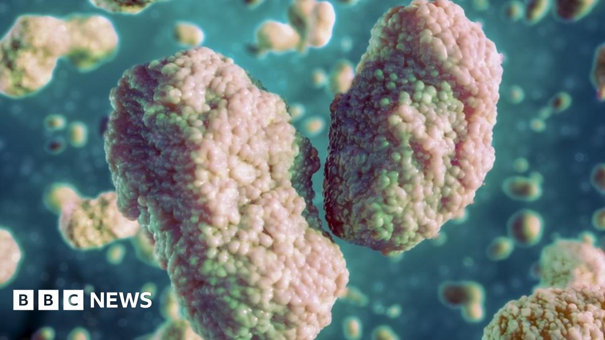 Monkeypox: Cases detected in three more countries for first time - BBC News