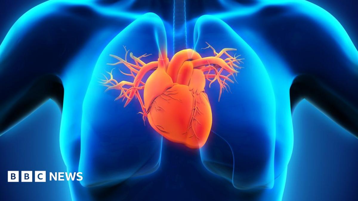 Heart doctors 'held back stent death data' - BBC News