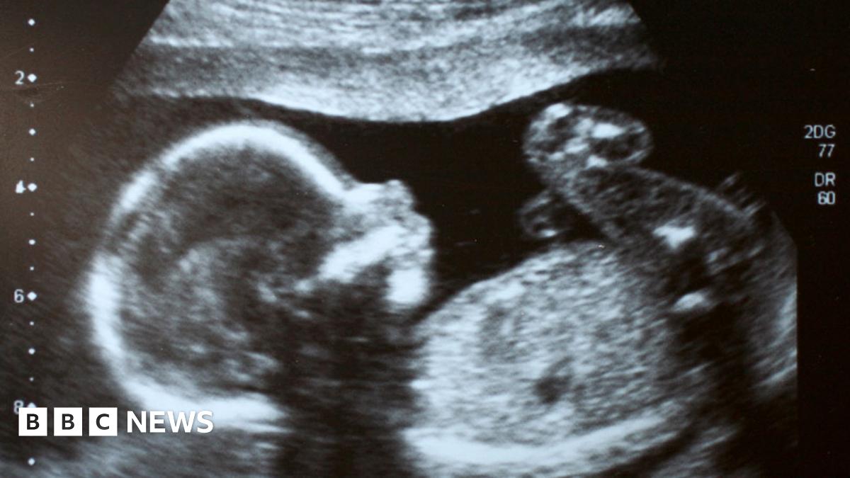 Editing human embryos 'morally permissible' - BBC News