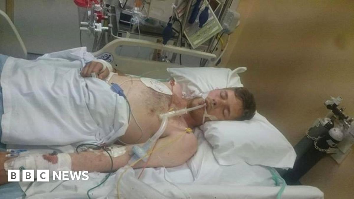 Jordan Blackburn coma photo to raise drugs awareness - BBC News