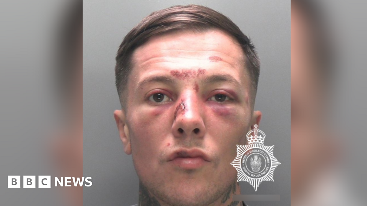 Kinmel Bay: Dog owners sentenced for holiday park attack - BBC News