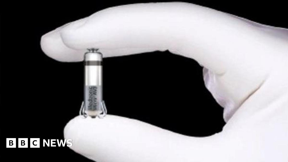 Northampton Hospital is among the first to fit new pacemaker - BBC News