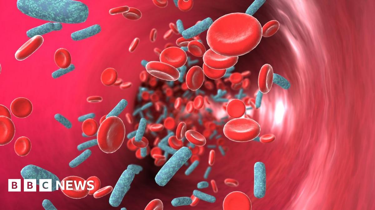 Sepsis: Why can it be so hard to spot? - BBC News